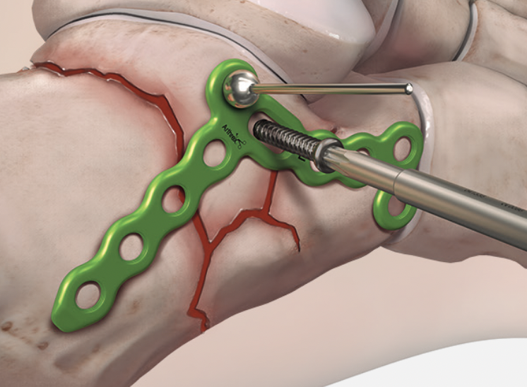 Management | The Bone School